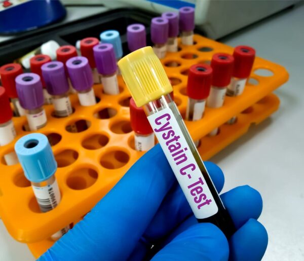 Serum Protein - SR Bioera